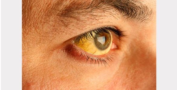 Problemet me fytyrën – treguesit e fshehur të sëmundjeve – Page 5 ...